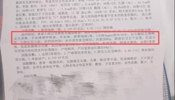 右脚缺4趾产检未发现